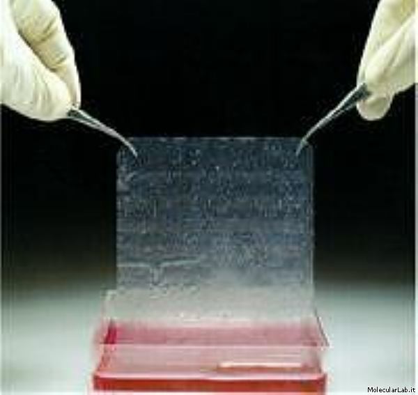 Creata in Italia protesi biotech di trachea